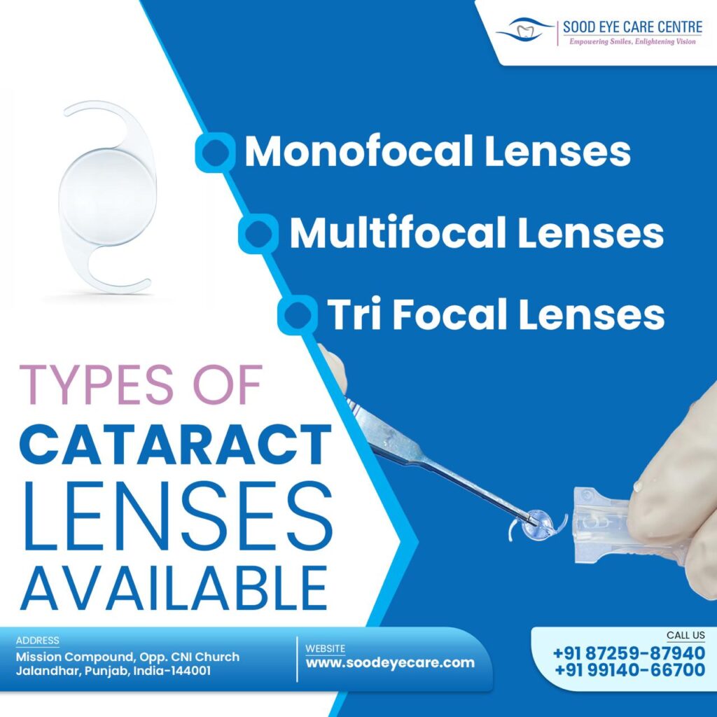 Types of Cataract Lenses in Jalandhar | Sood Eye Care Centre